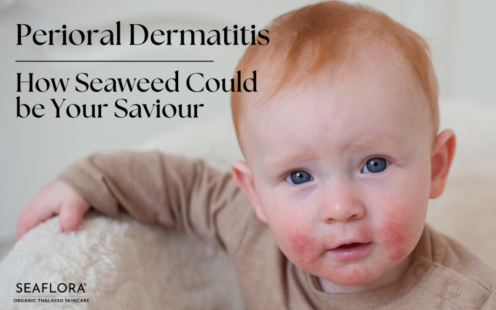 perioral dermatitis - Seaflora Skincare